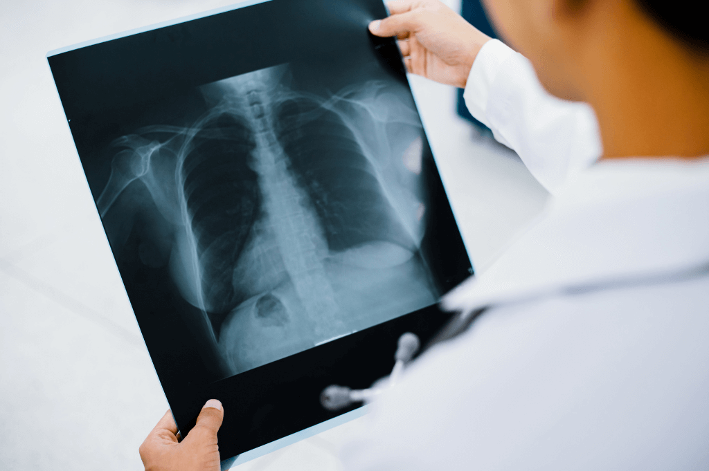 What Is a Pulmonologist: Education, Skills and Career Path | SUSOM