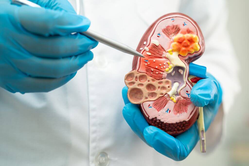 What Is a Nephrologist? Conditions Treated, Tests & Career Path