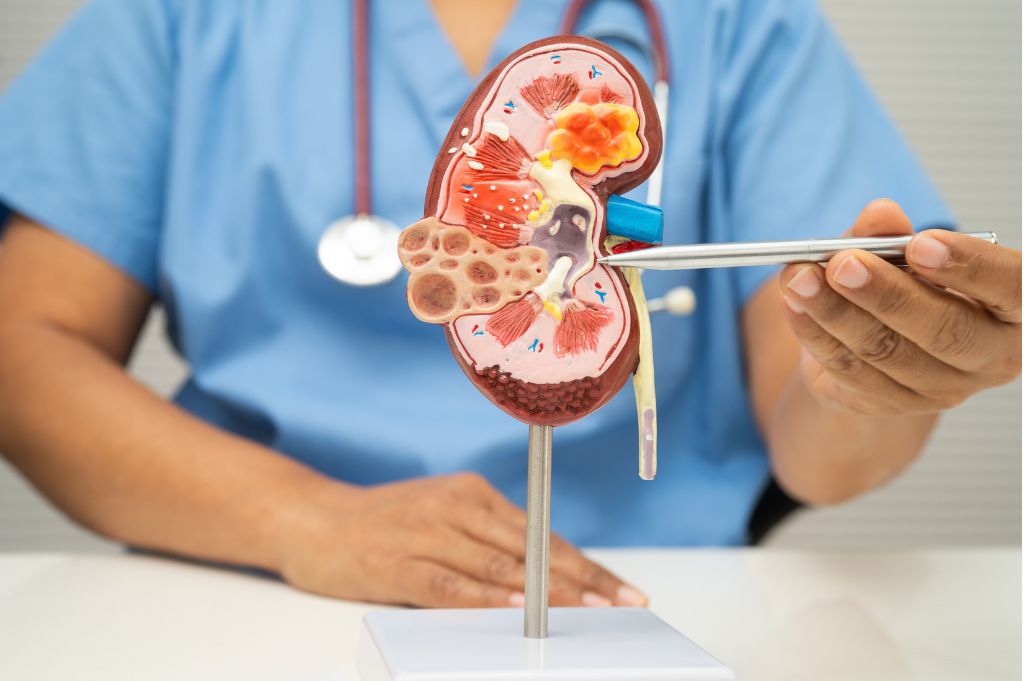 Nephrologist vs Urologist: Key Differences Explained | SUSOM